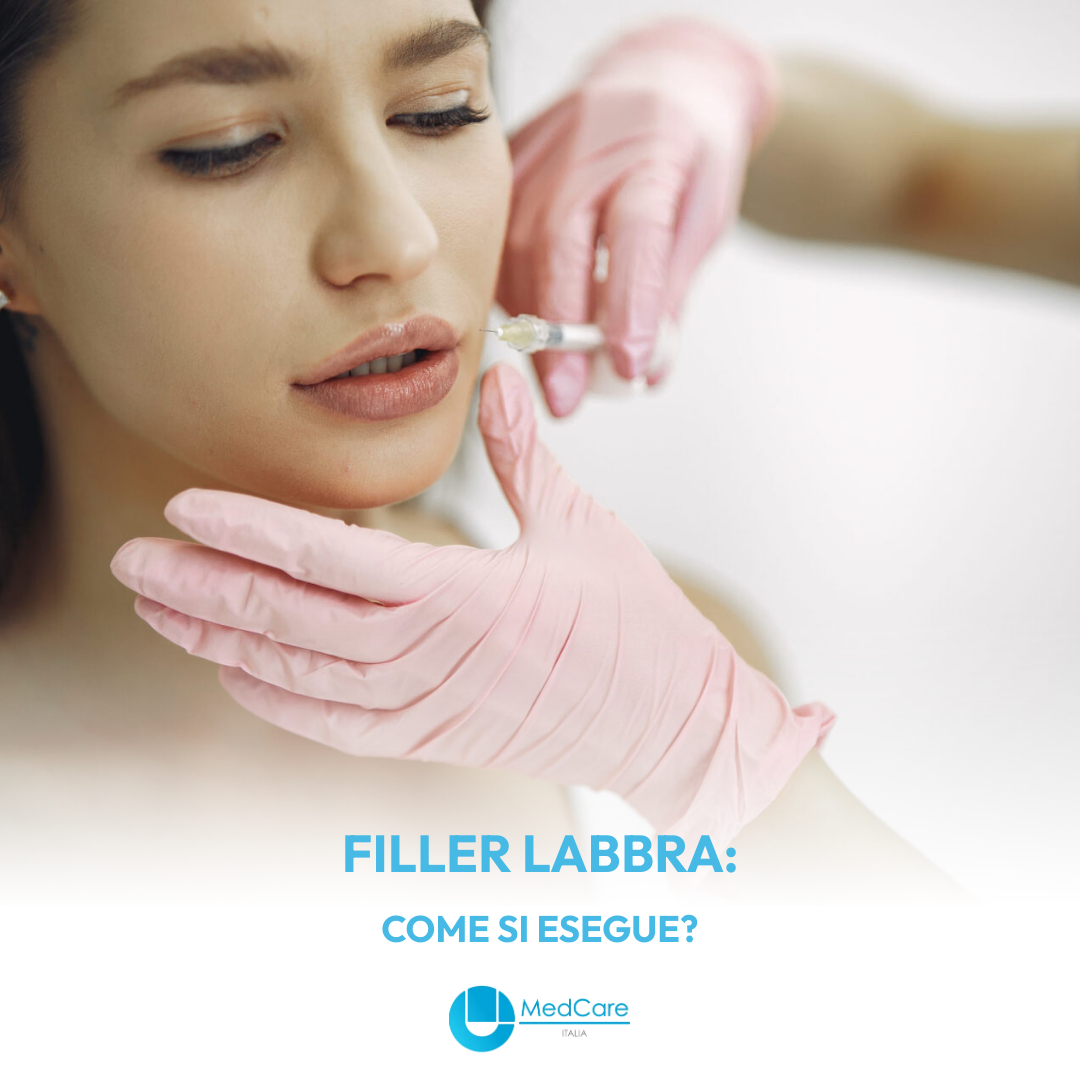 Filler Labbra: Come si esegue? - MedCare Italia